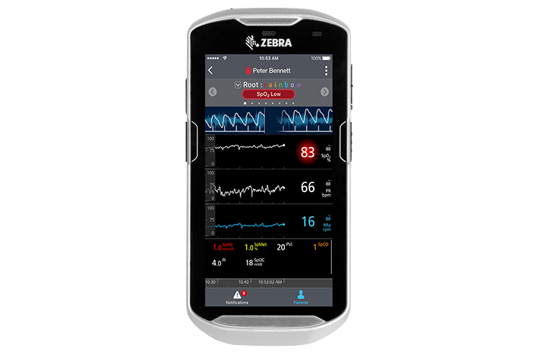 Masimo Patient SafetyNet | Devices Solution