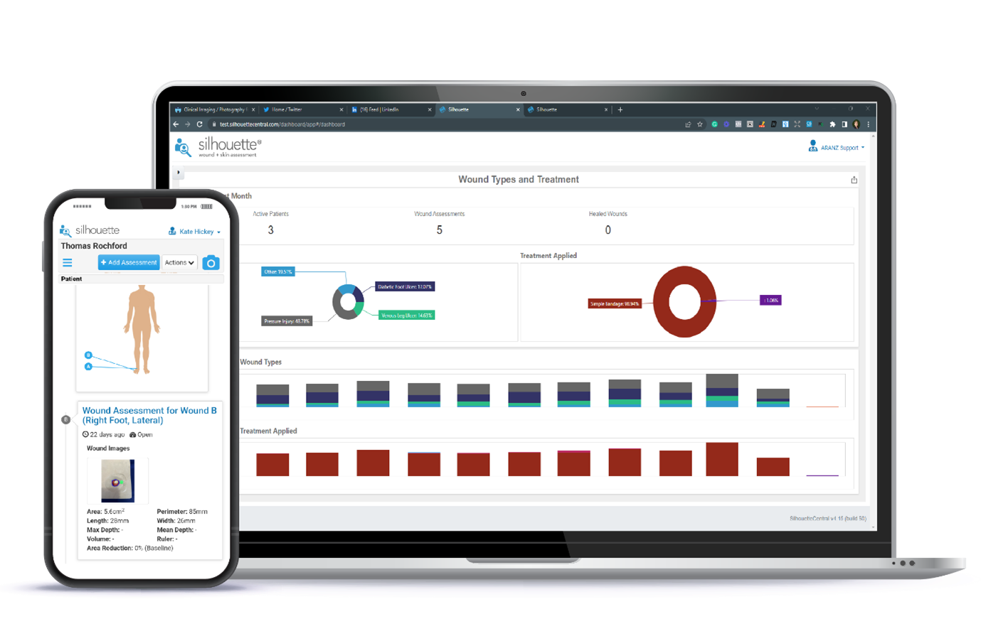 Silhouette | Devices Solution